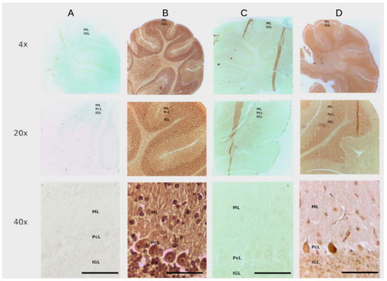 One Step Histological Detection and Staining of the PTEN Tumor ...