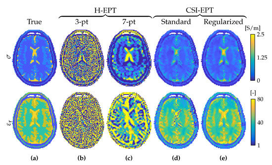 Electrical Properties Tomography: A Methodological Review
