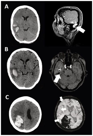 MR-Imaging and Histopathological Diagnostic Work-Up of Patients with ...
