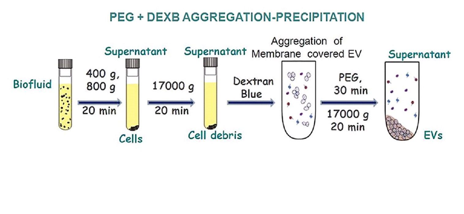 Diagnostics | Free Full-Text | Isolation of Extracellular Vesicles from ...