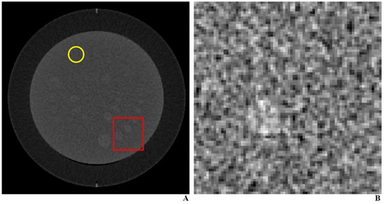 Robustness of Deep Learning Algorithm to Varying Imaging Conditions in ...