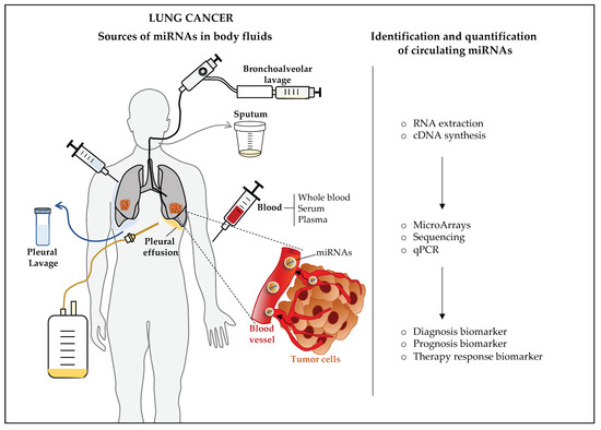 Circulating MicroRNAs in Blood and Other Body Fluids as Biomarkers for ...