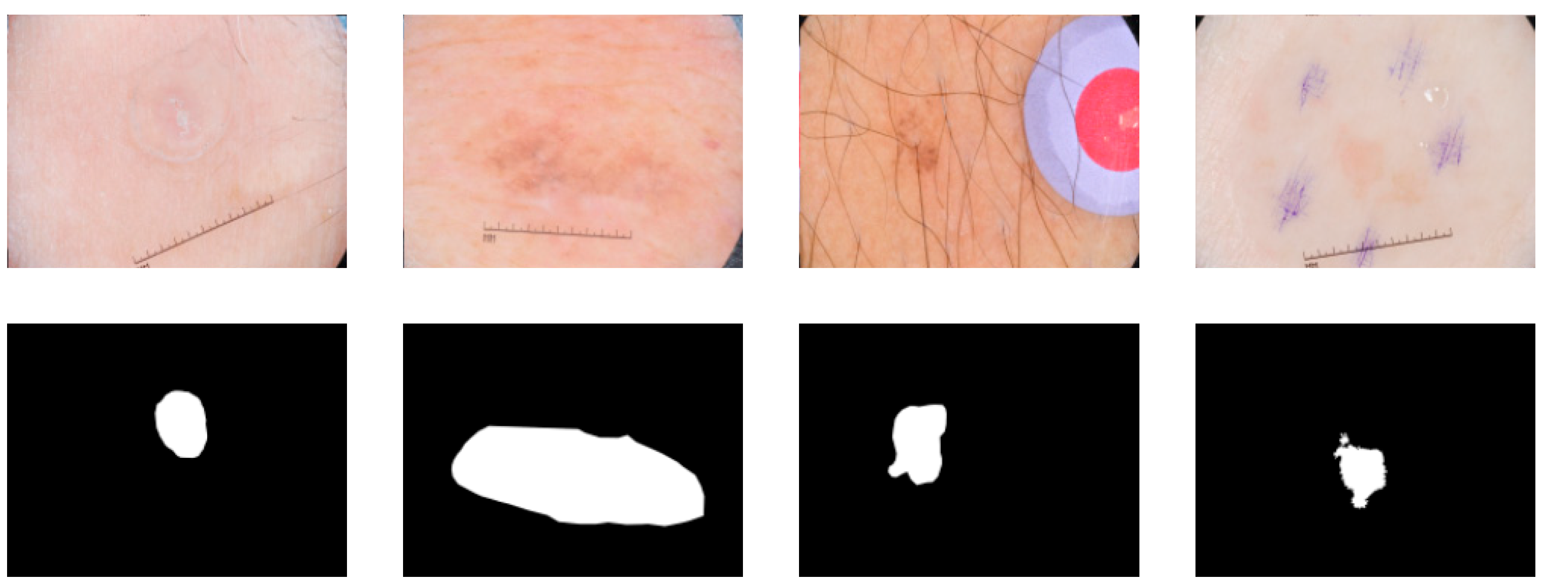 ASCU-Net: Attention Gate, Spatial and Channel Attention U-Net for Skin ...