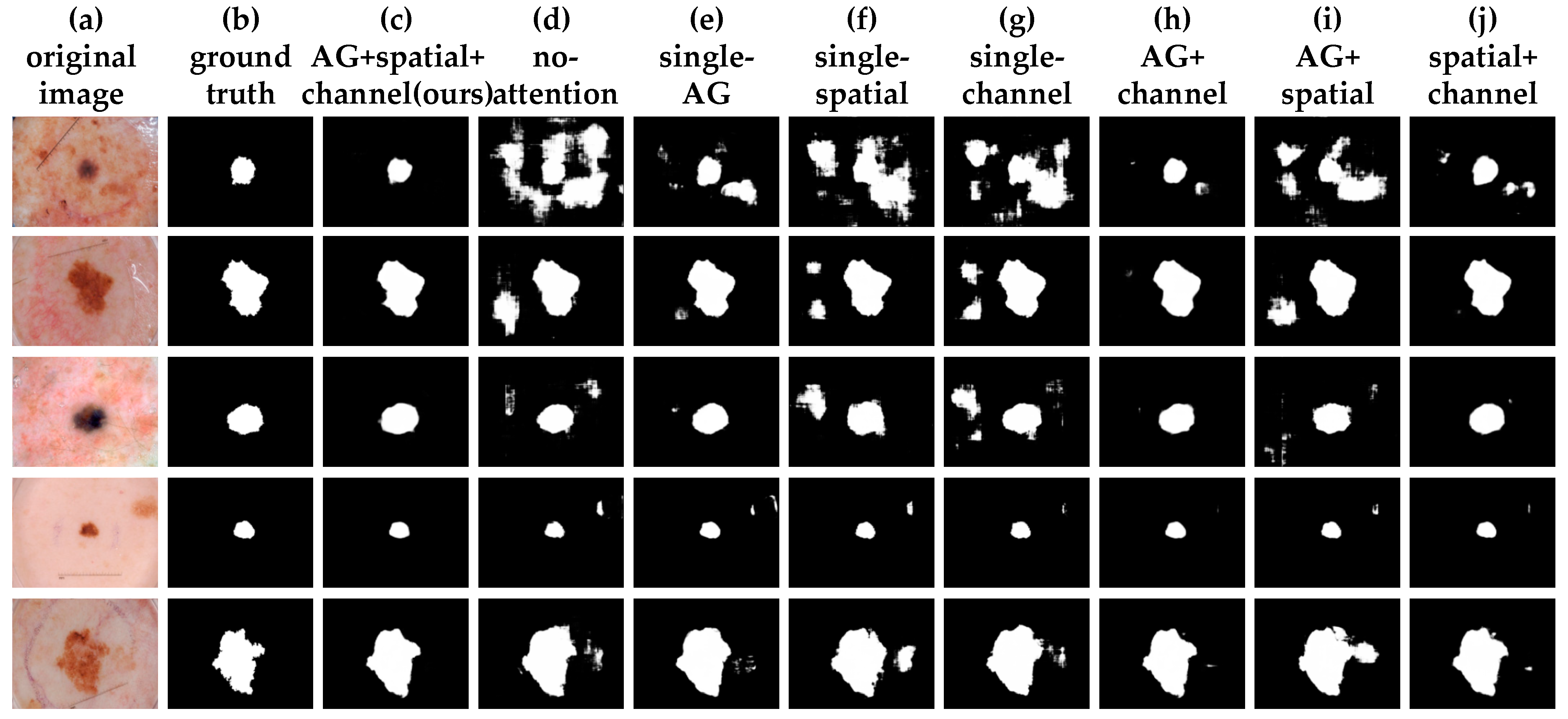 ASCU-Net: Attention Gate, Spatial and Channel Attention U-Net for Skin ...