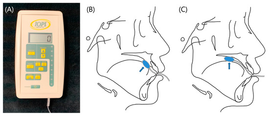 Diagnostics | Free Full-Text | Comparative Analysis of the Differences ...