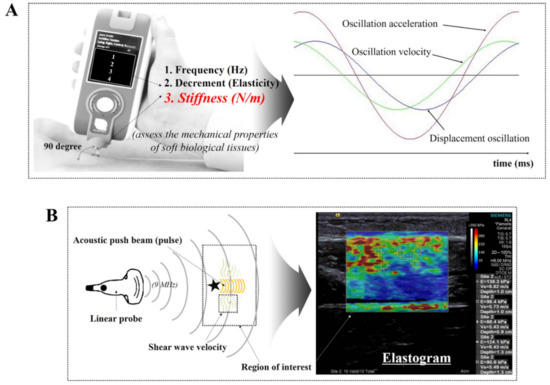 The Measurement of Stiffness for Major Muscles with Shear Wave ...