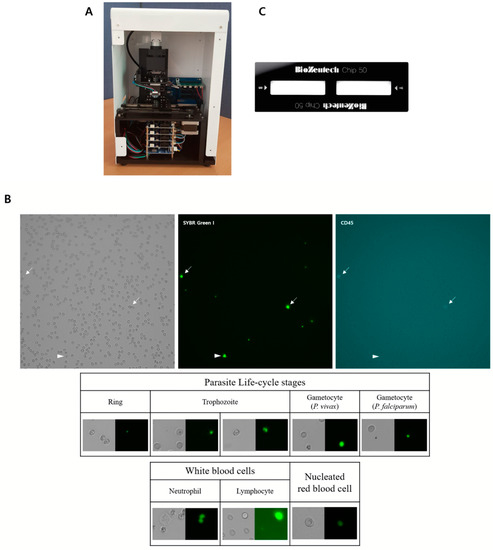 An Automated Microscopic Malaria Parasite Detection System Using Digital Image Analysis