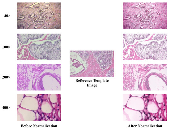 Diagnostics | Free Full-Text | Conventional Machine Learning versus ...