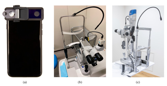 Clinical Observation of Allergic Conjunctival Diseases with Portable ...