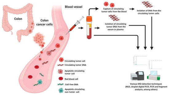 Microsatellite Instability in Colorectal Cancer Liquid Biopsy—Current ...