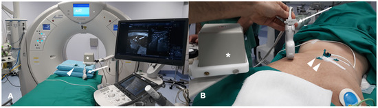 Diagnostics | Special Issue : Percutaneous Imaging-Guided Techniques in ...