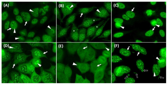 Application of Supervised Machine Learning to Recognize Competent Level ...