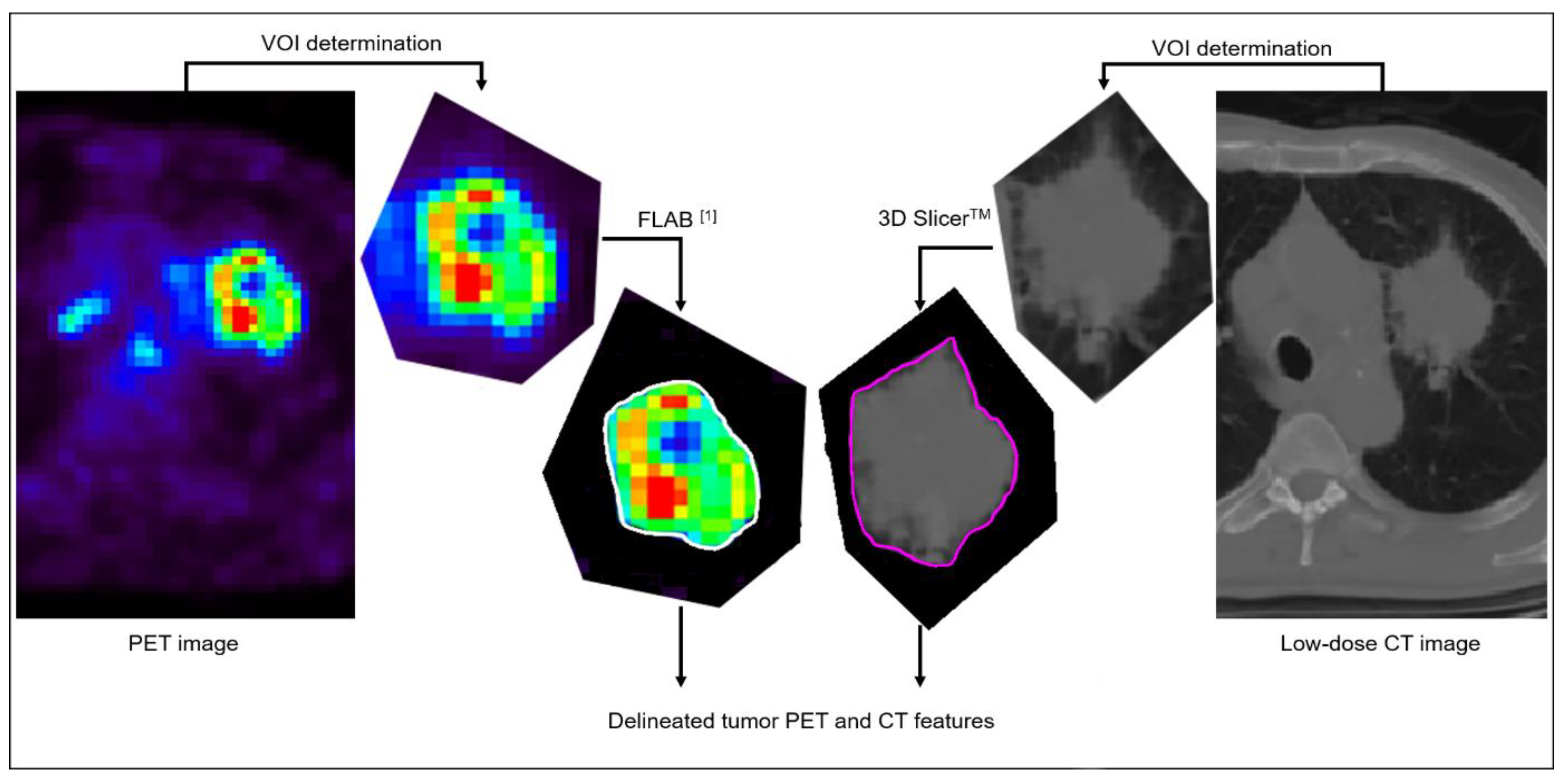 Comparison and Fusion of Machine Learning Algorithms for Prospective ...