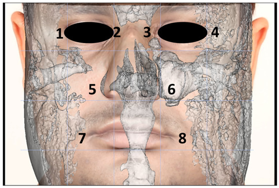 Diagnostics | Free Full-Text | Accuracy and Reproducibility of Facial ...