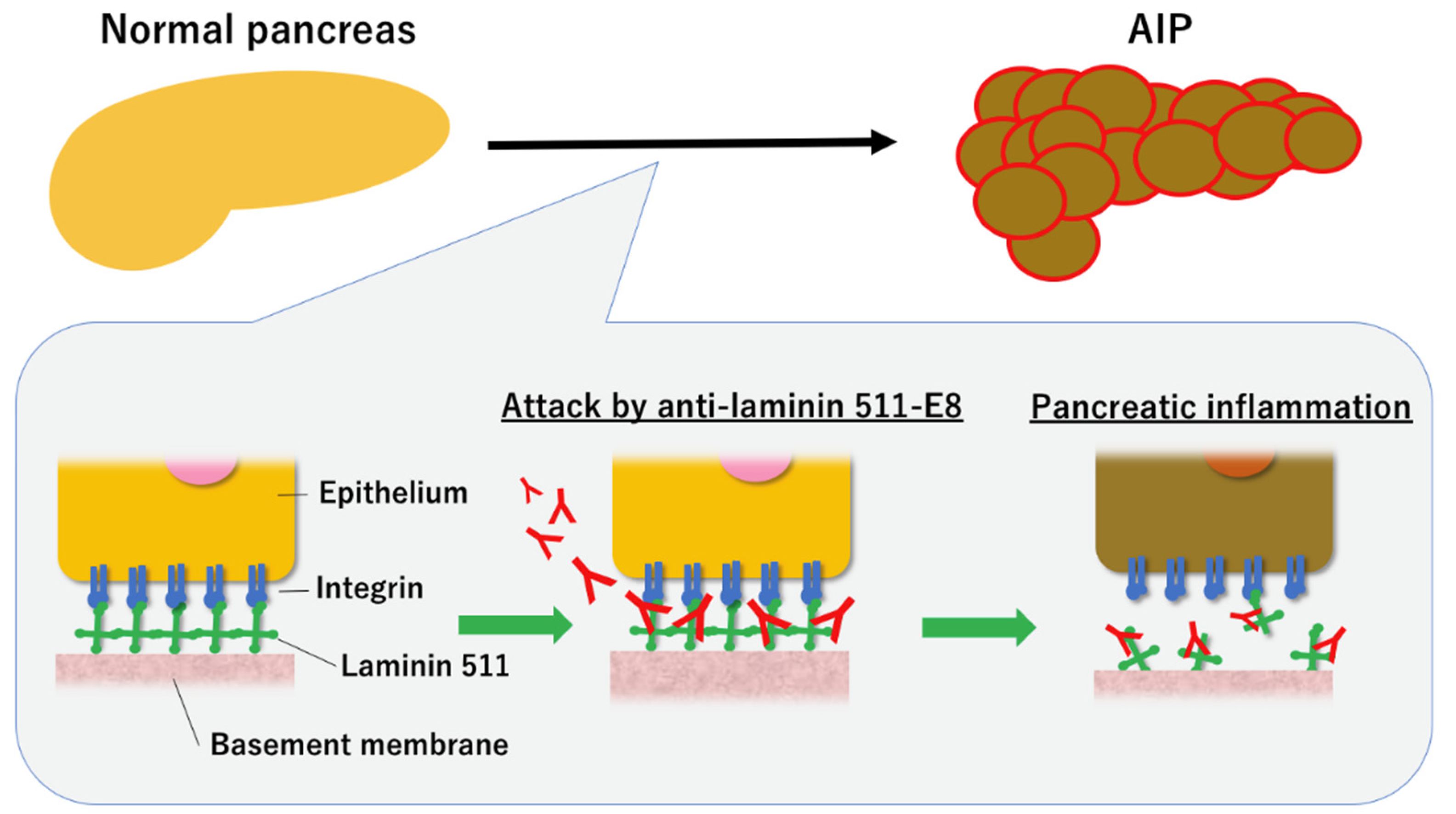 Review of Diagnostic Biomarkers in Autoimmune Pancreatitis: Where Are ...