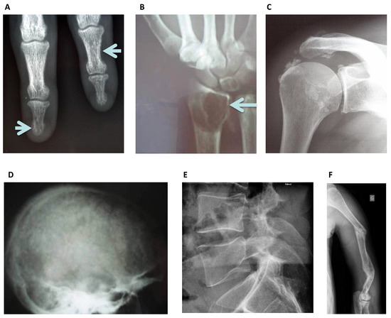 The Use of Imaging Techniques in Chronic Kidney Disease-Mineral and ...