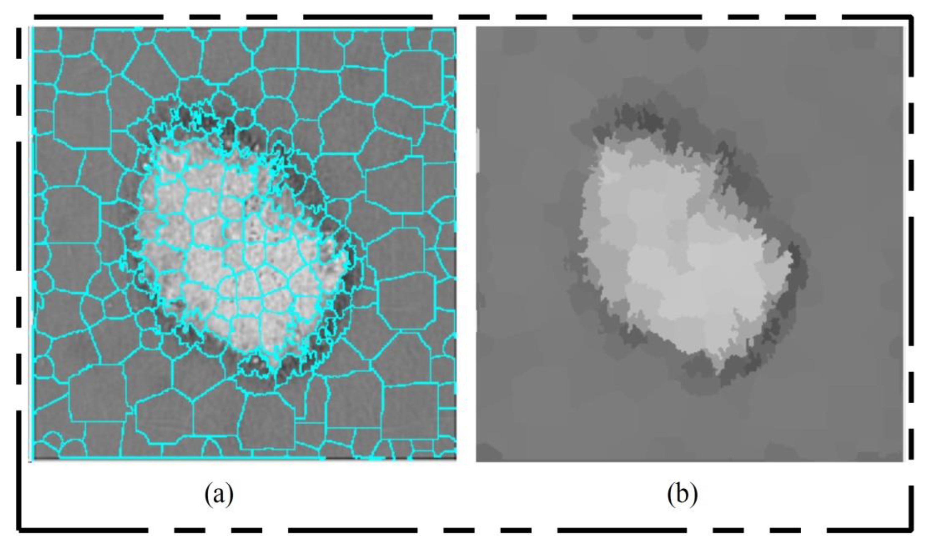 Skin Lesion Segmentation and Multiclass Classification Using Deep Learning Features and Improved ...