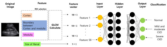 Classification of Chronic Kidney Disease in Sonography Using the GLCM ...