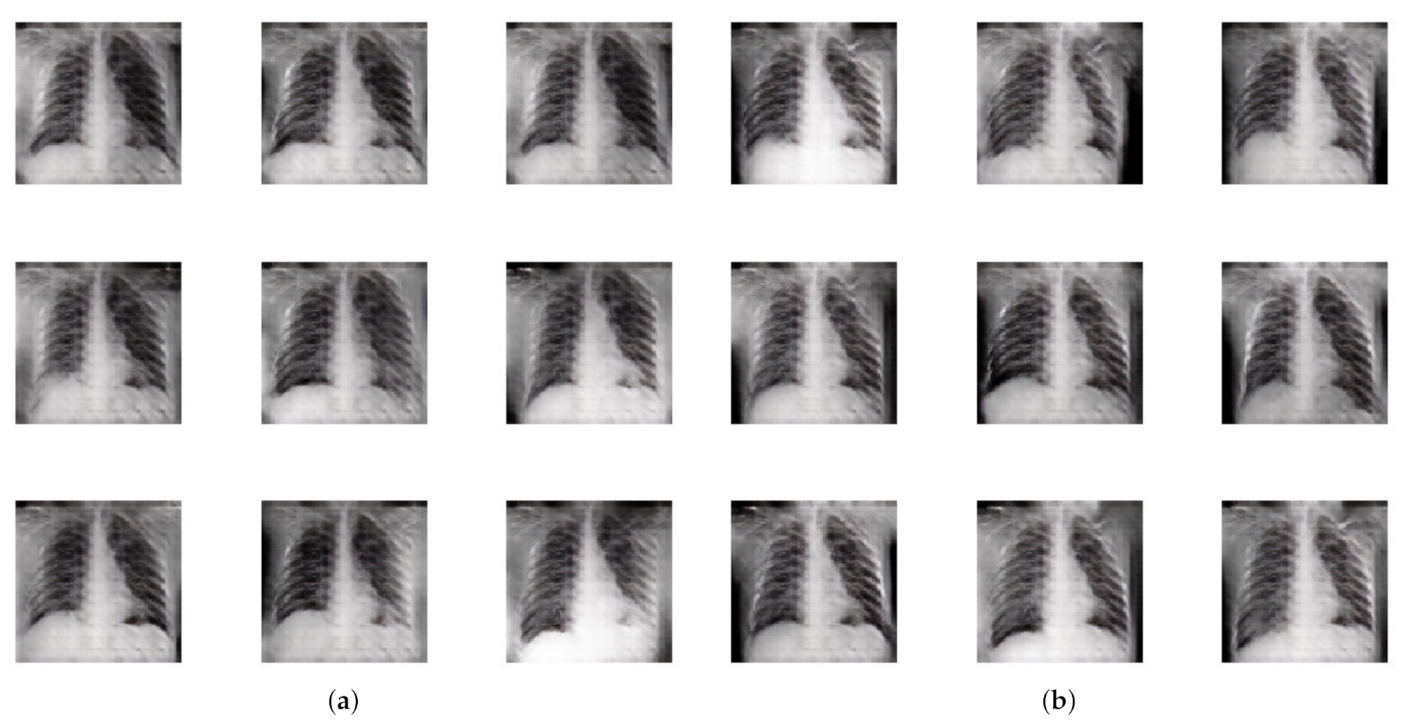 Diagnostics | Free Full-Text | Generation of Synthetic Chest X-ray ...