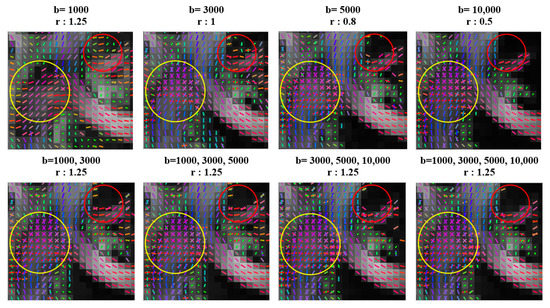 Diagnostics | Free Full-Text | Effect of Multishell Diffusion MRI Acquisition Strategy and ...