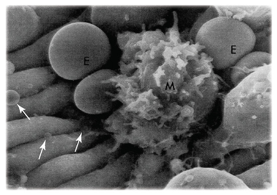 Diagnostics | Free Full-Text | Red Blood Cells: Tethering, Vesiculation ...