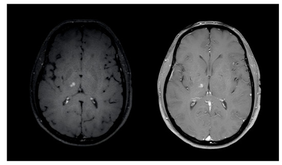 Diagnostics | Special Issue : Whole Body MRI: Major Advances and Future ...