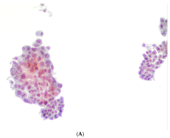 Diagnostics | Special Issue : Cyto-Histopathological Correlations in ...