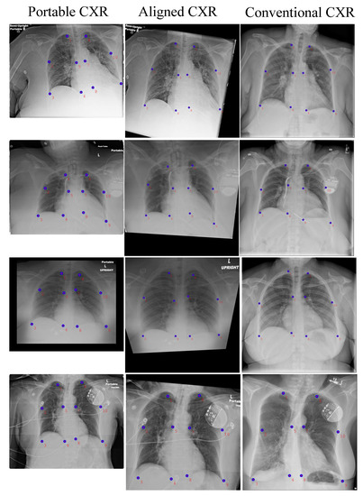 Diagnostics | Free Full-Text | Enhance Portable Radiograph for Fast and ...