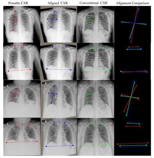 Diagnostics | Special Issue : Advances in Diagnostic Medical Imaging