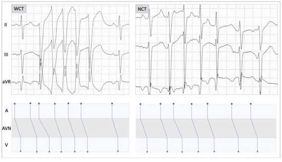 Integrating Electrocardiography and Vectorcardiography in the ...