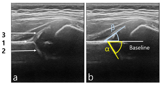 Accuracy of New Deep Learning Model-Based Segmentation and Key-Point ...