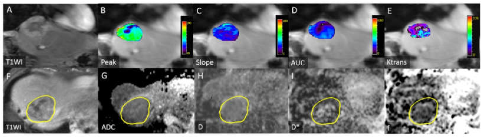 Dynamic Contrast-Enhanced and Intravoxel Incoherent Motion MRI ...