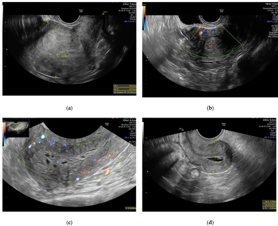 Diagnostics | Free Full-Text | The Correlation of the IETA Ultrasound ...