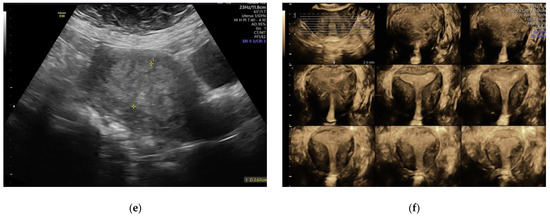 Diagnostics | Free Full-Text | The Correlation of the IETA Ultrasound ...