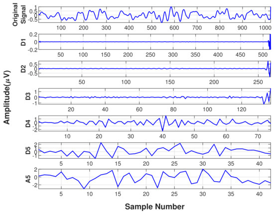 Automated Characterization of Cyclic Alternating Pattern Using Wavelet-Based Features and ...