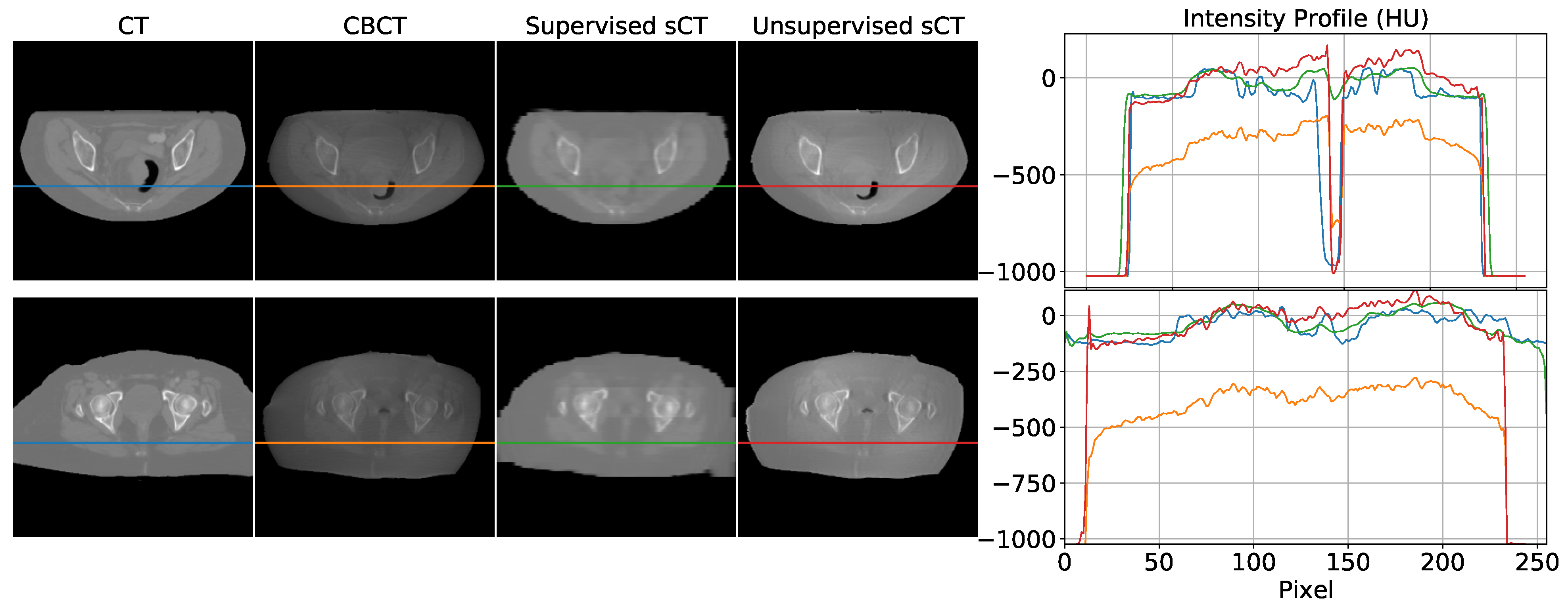 Comparison of Supervised and Unsupervised Approaches for the Generation ...