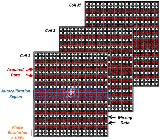 Feasibility and Implementation of a Deep Learning MR Reconstruction for ...