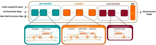 Feasibility and Implementation of a Deep Learning MR Reconstruction for ...