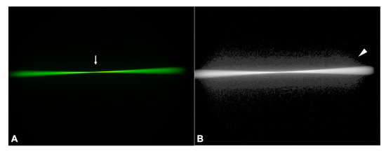 Visualization of Forward Light Scatter in Opacified Intraocular Lenses ...