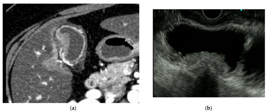 Diagnostics | Special Issue : Recent Advances in Diagnosis of ...
