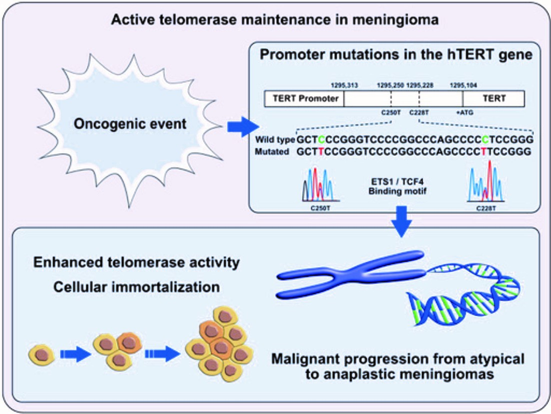 Diagnostics | Free Full-Text | Human TERT Promoter Mutations in Atypical and Anaplastic Meningiomas