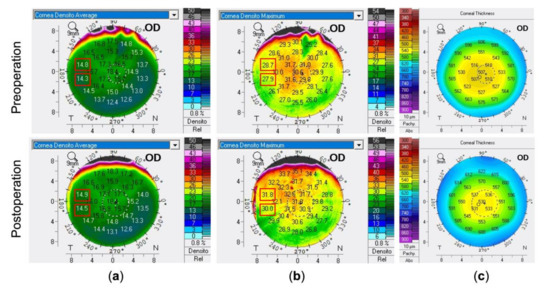 Simultaneously Monitoring Whole Corneal Injury with Corneal Optical ...