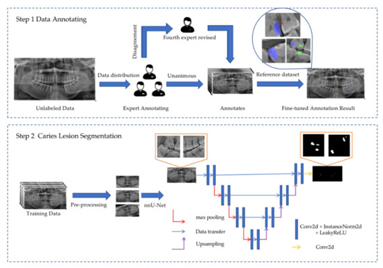 Deep Learning for Caries Detection and Classification