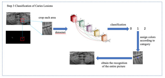 Diagnostics | Free Full-Text | Deep Learning for Caries Detection and ...