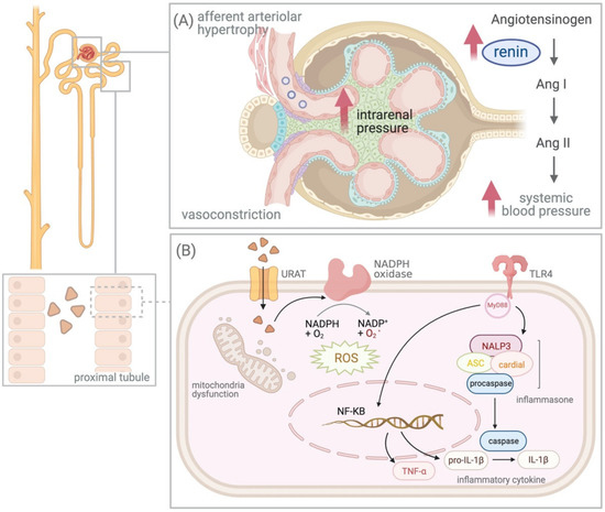Hyperuricemia and Progression of Chronic Kidney Disease: A Review from ...