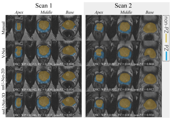 The Reproducibility of Deep Learning-Based Segmentation of the Prostate ...