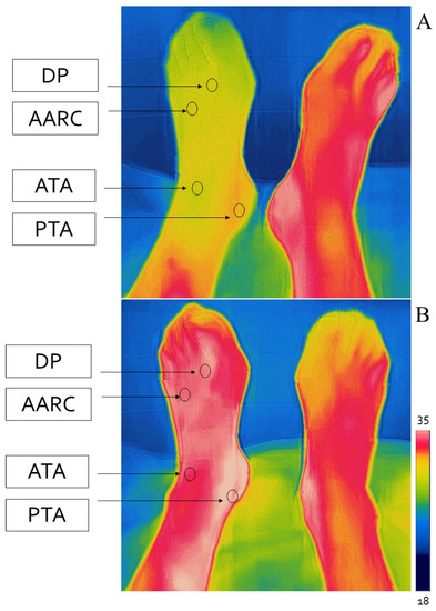 Infrared Thermography as a Diagnostic Tool for the Assessment of ...