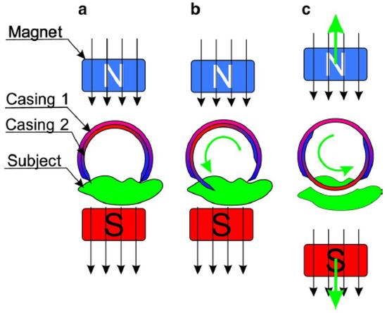 Capsule Endoscopy: Pitfalls and Approaches to Overcome