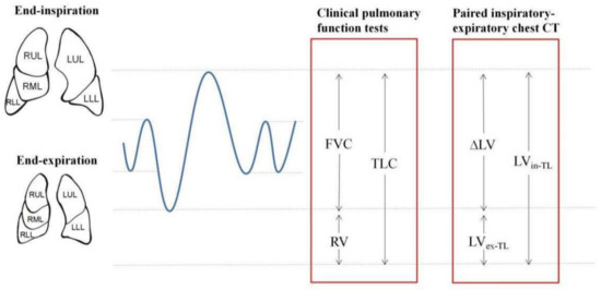 Diagnostics | Free Full-Text | Total Lung and Lobar Quantitative ...