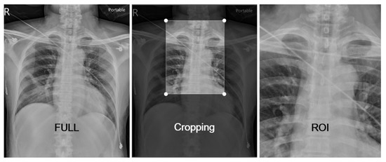 Using Transfer Learning Method to Develop an Artificial Intelligence ...